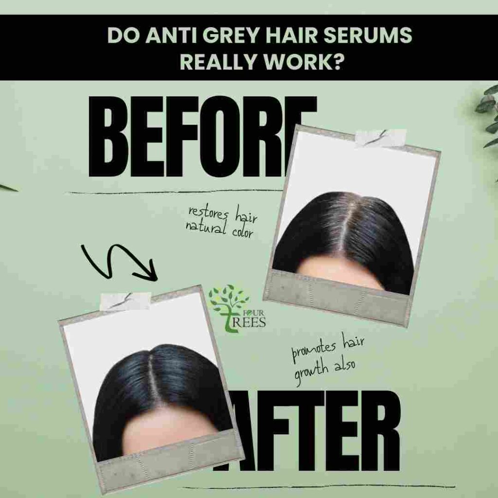 Do Anti Grey Hair Serum Really Work? Here's the Truth - Four Trees ...